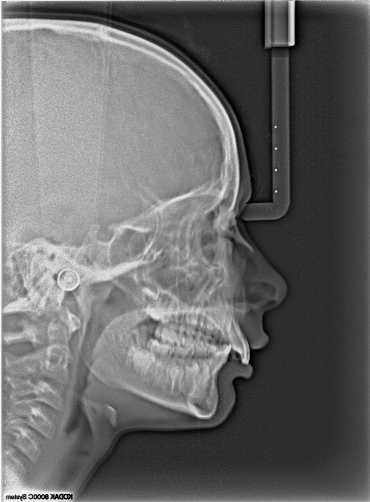Diagnose en behandelplan - beugel